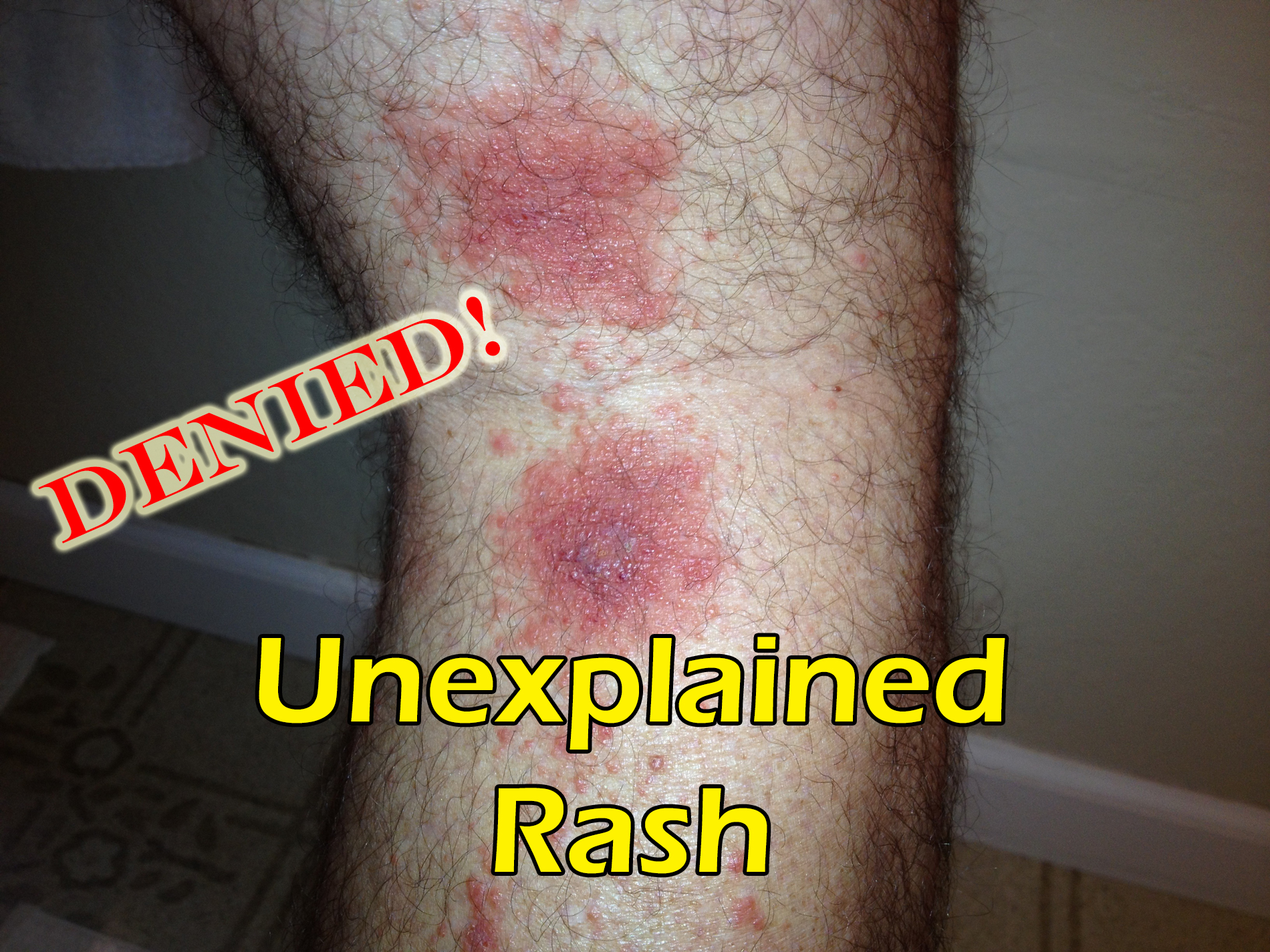 Why can’t I buy health insurance when I need it?